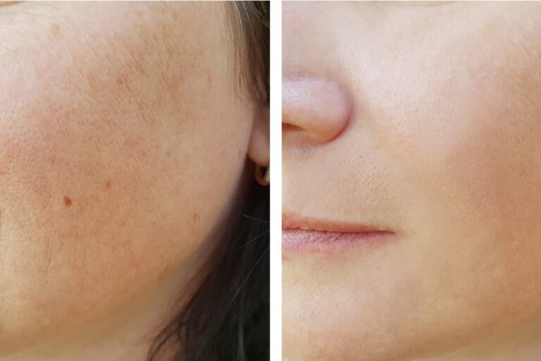 Gallery | Desert Dermatology
