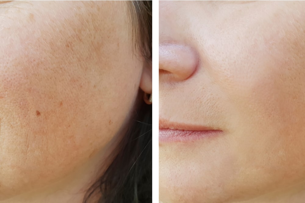 Gallery | Desert Dermatology